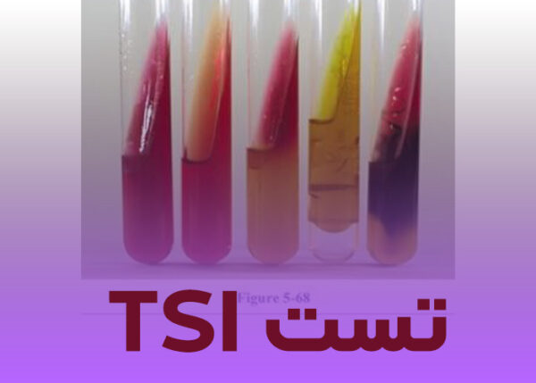 تست TSI | محیط، پروتکل و تفسیر - پویاژن آزما